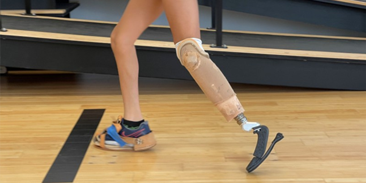 Revolutionizing prosthetics for kids: A modular approach that grows ...