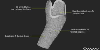 How AI is Helping Power Next-Generation Prosthetic Limbs