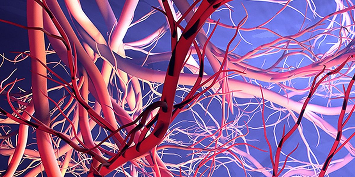 3D micro-ice printing for medical applications