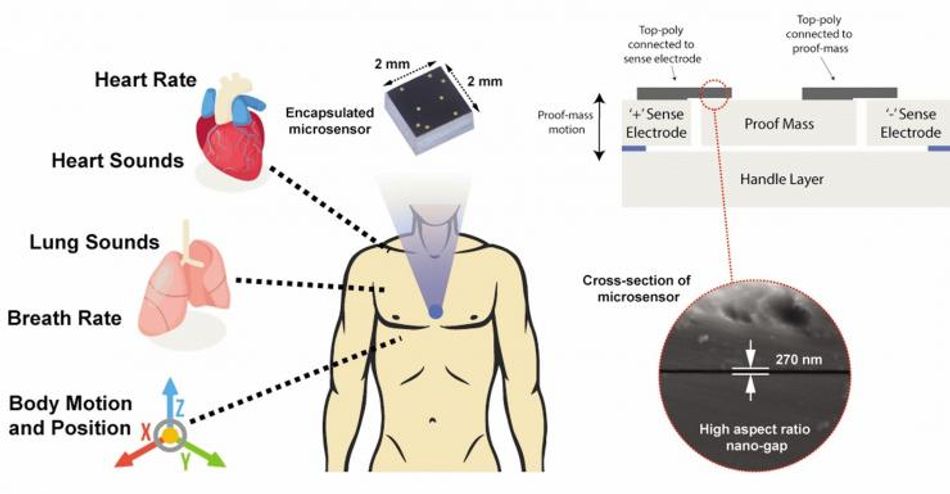 Super Sensor On A Chip can Monitor the Heart and Lungs using Sounds ...